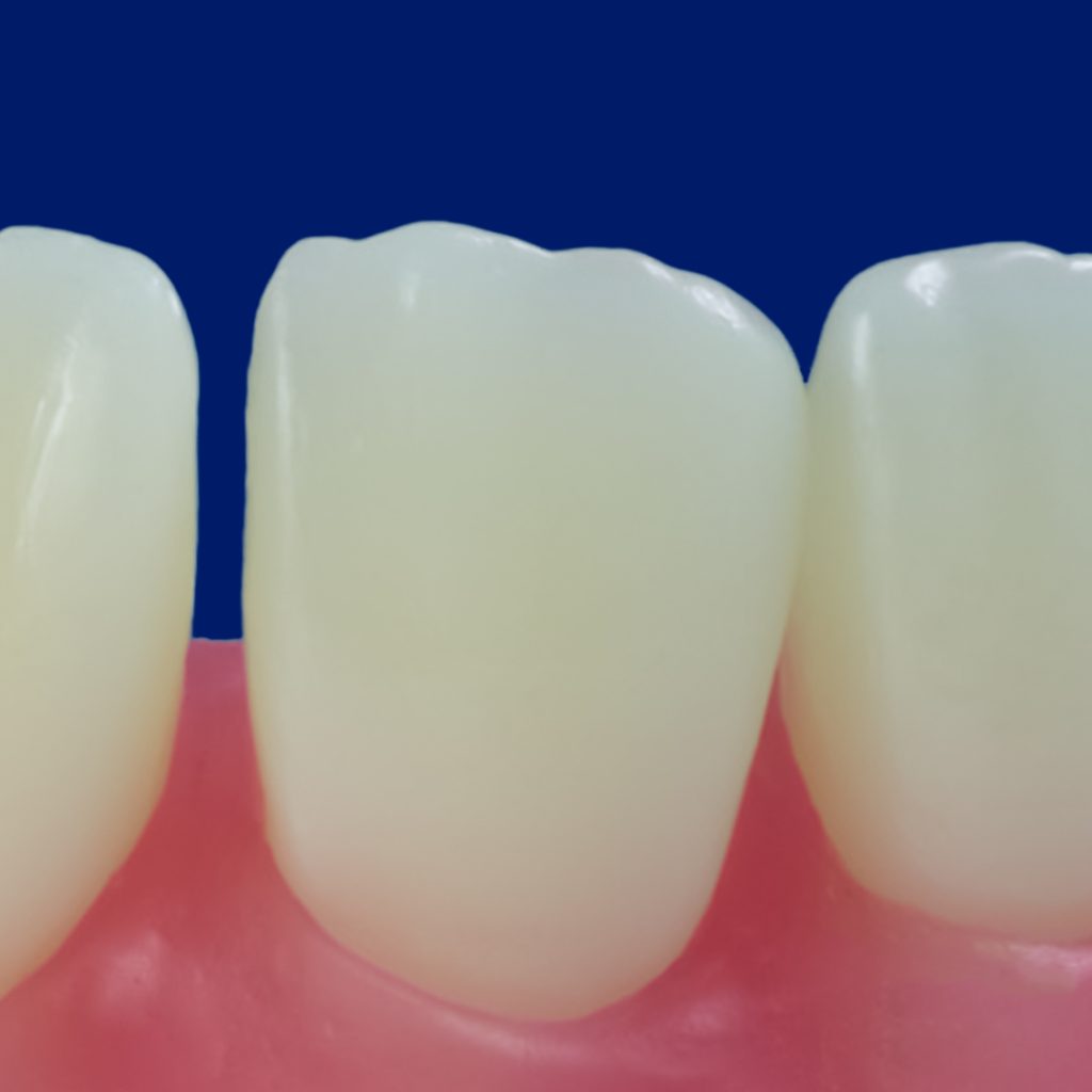 Dentes Diferenciados - Pronew Odonto