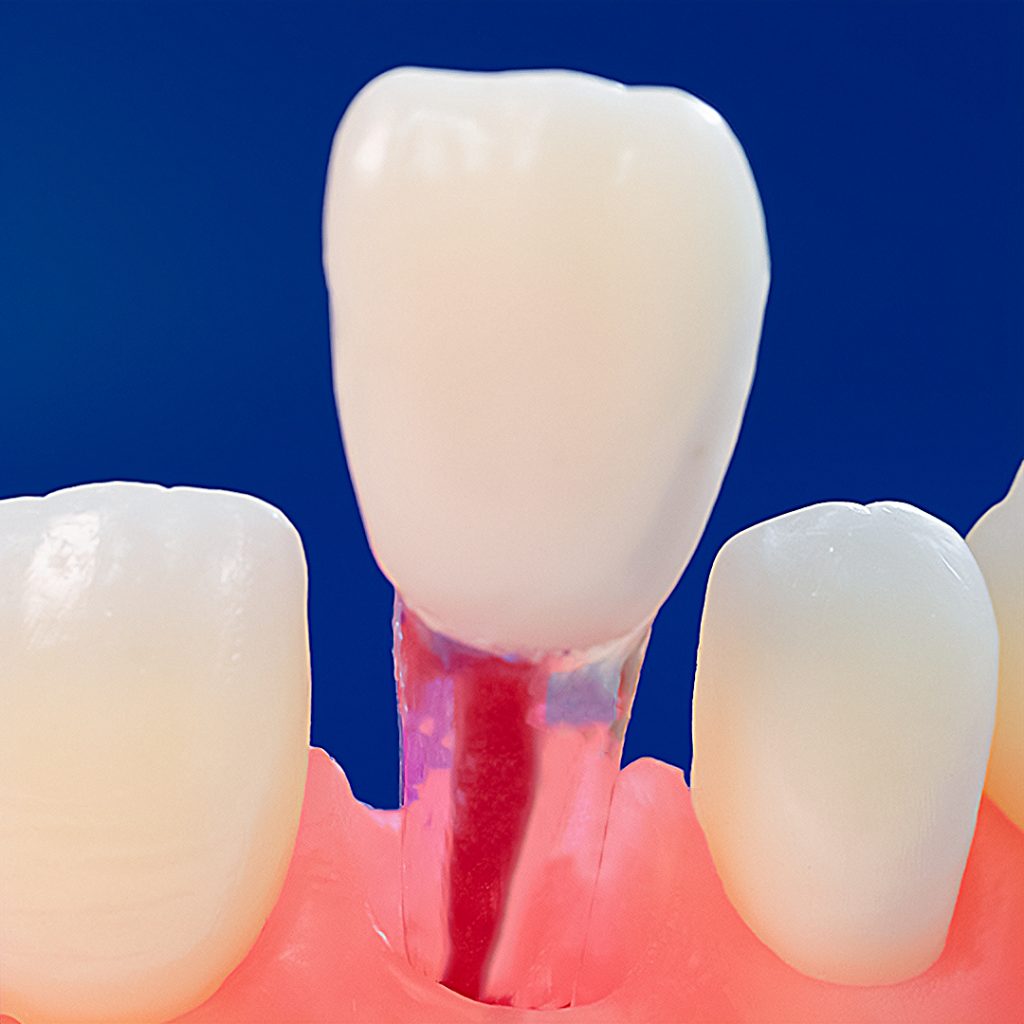 Dentes Diferenciados - Pronew Odonto